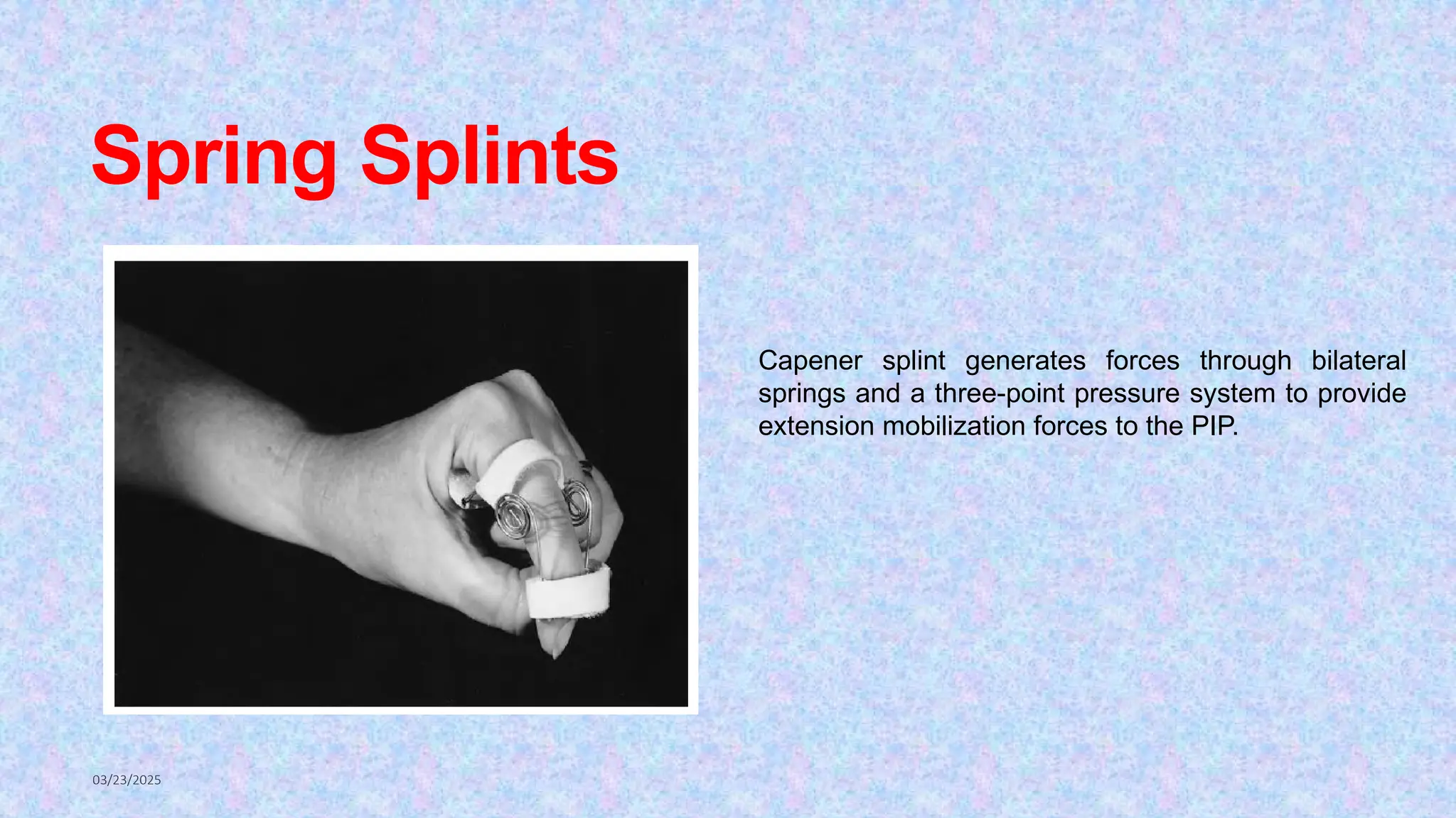 Classification_and_Nomenclature_of_Splints_at_pdinuid.pptx