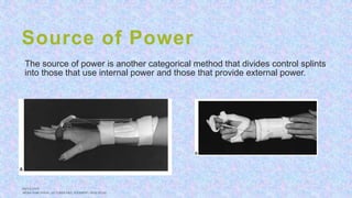 Classification_and_Nomenclature_of_Splints_at_pdinuid.pptx