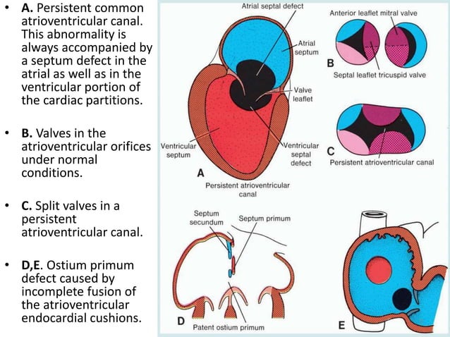 Heart Defects | PPTX