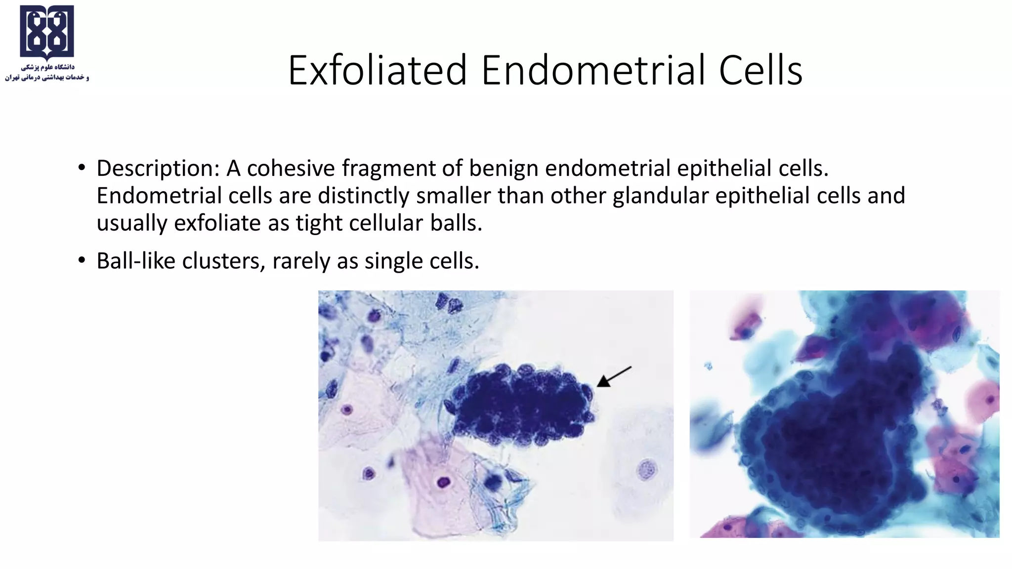Pap smaer cytology | PDF