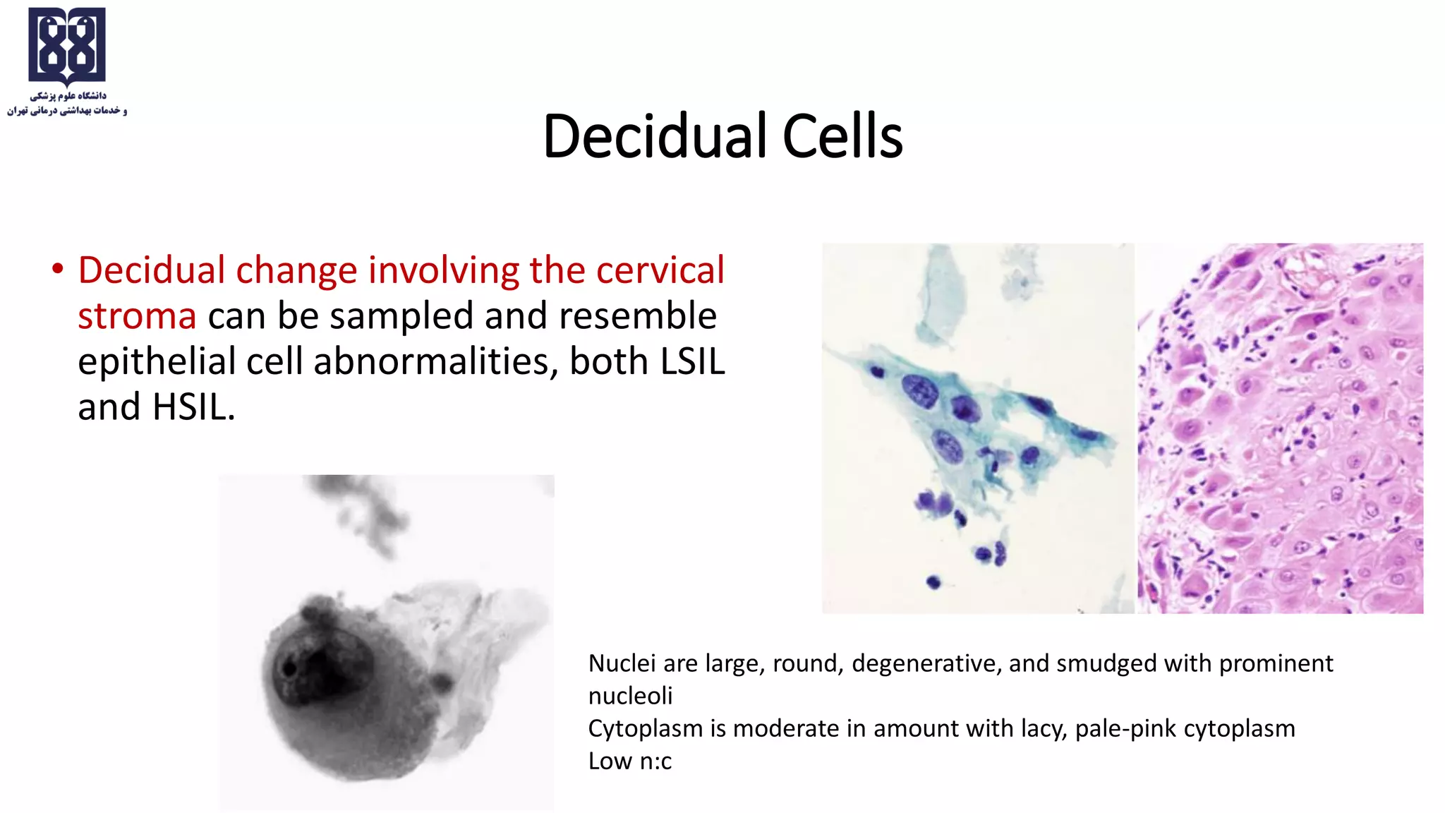Pap smaer cytology | PDF