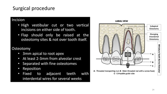 7 MIDFACE ORTHOGNATHIC PROCEDURE seminar 7.pptx | Ear, Nose and Throat ...