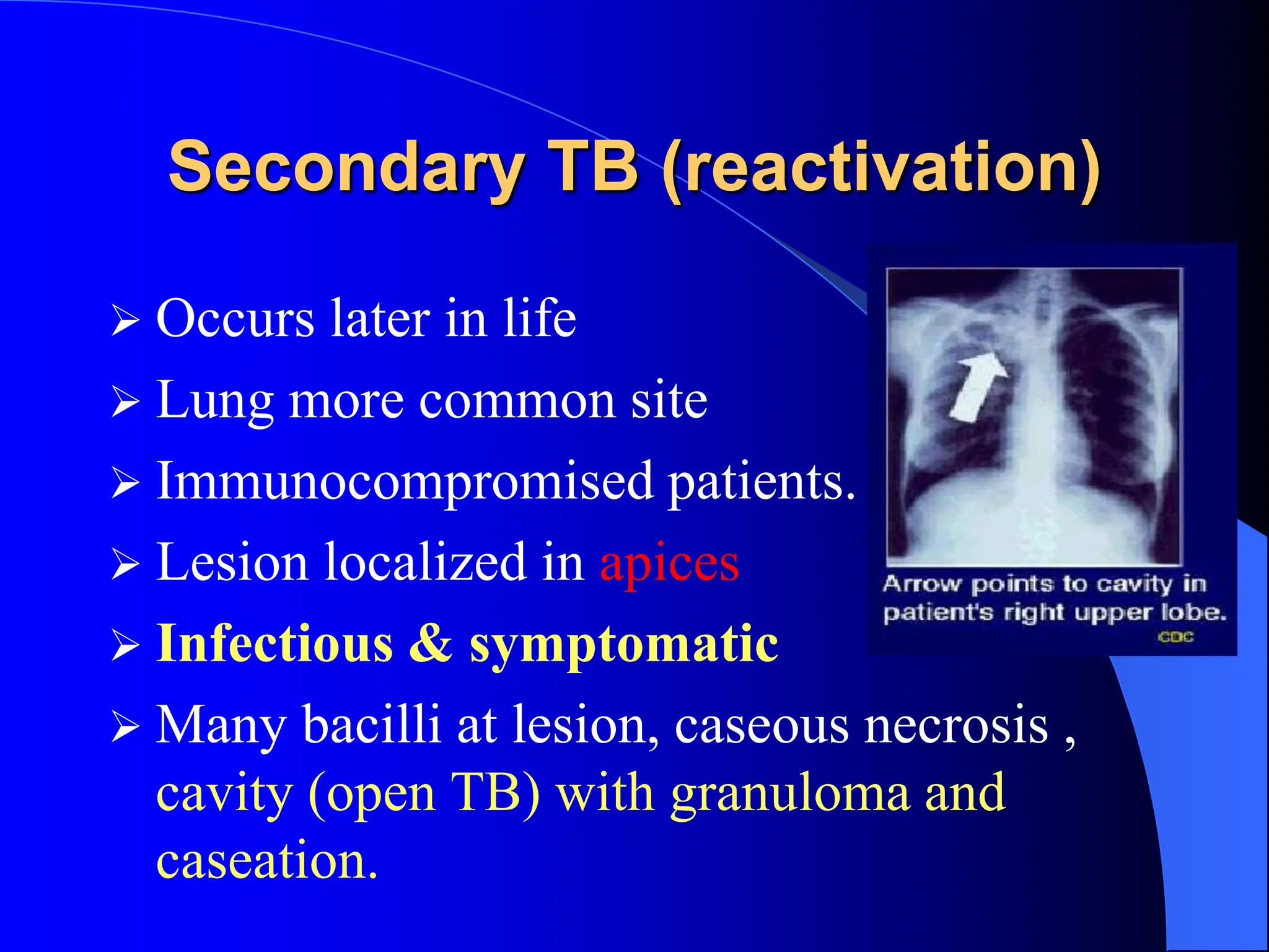 mycobacteria -TB.ppt- laboratory medicine | PPT
