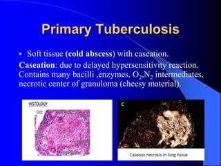 mycobacteria -TB.ppt- laboratory medicine | PPT