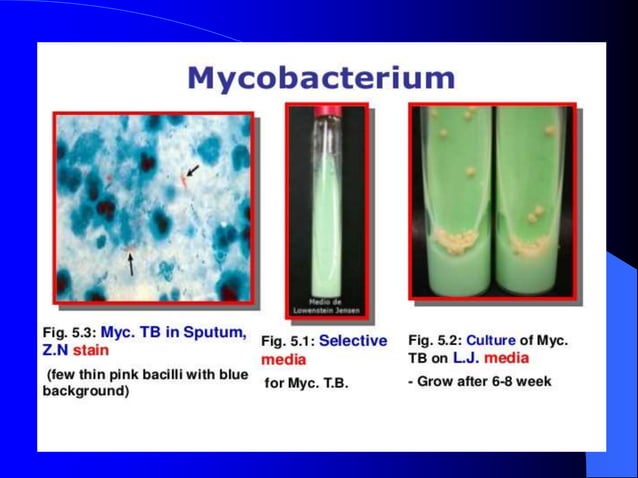 mycobacteria -TB.ppt- laboratory medicine | PPT