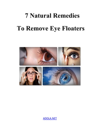 7 Natural Remedies To Remove Eye Floaters | PDF