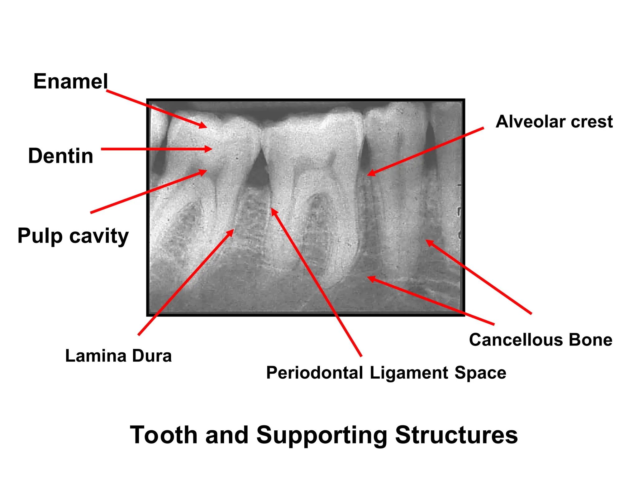 7 Normal Anatomical Landmarks OF MAXIILA AND MANDIBLE.ppt