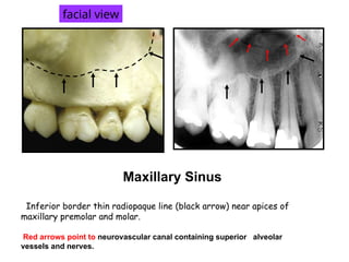7 Normal Anatomical Landmarks OF MAXIILA AND MANDIBLE.ppt