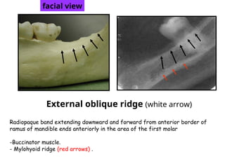 7 Normal Anatomical Landmarks OF MAXIILA AND MANDIBLE.ppt