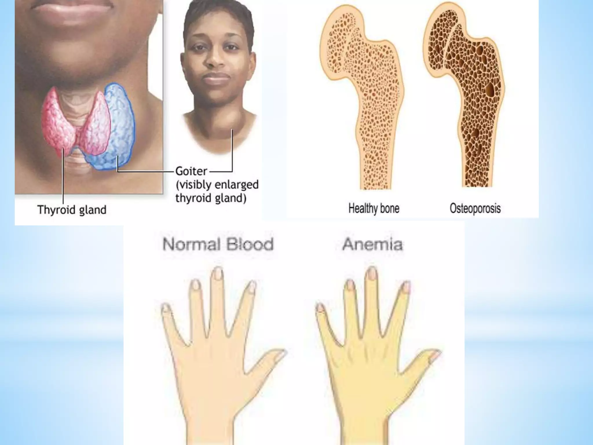 7 nutritional diseases | PPTX