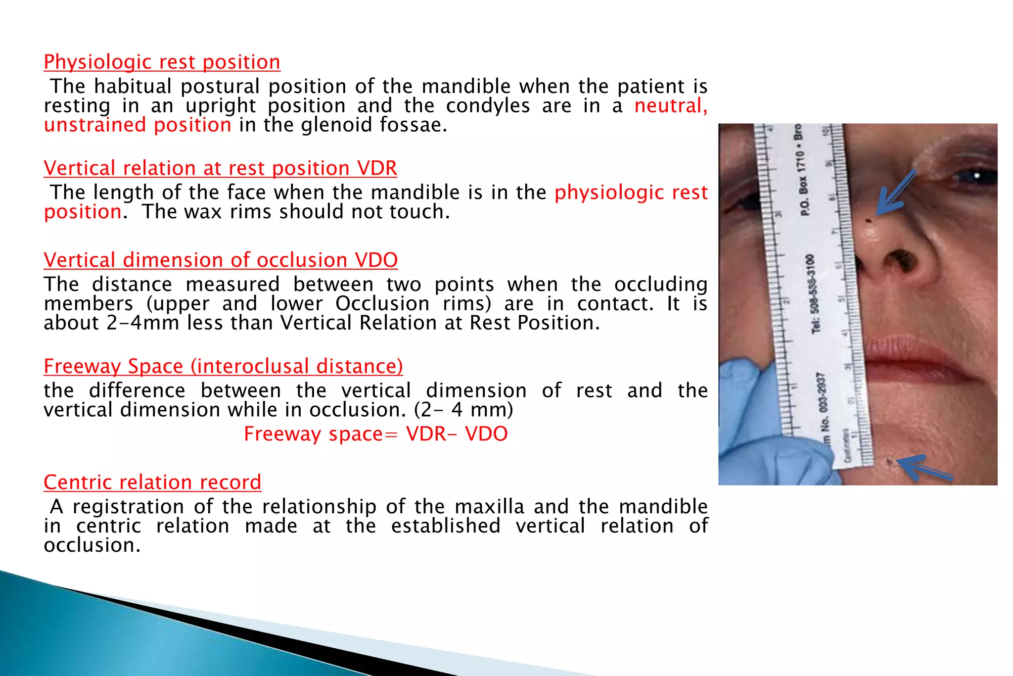 occlusion/jaw relation/ centric registeration 4th year tripoli | PPTX
