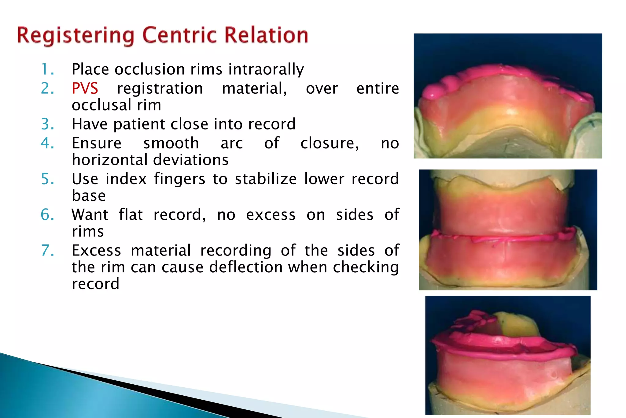 occlusion/jaw relation/ centric registeration 4th year tripoli | PPTX
