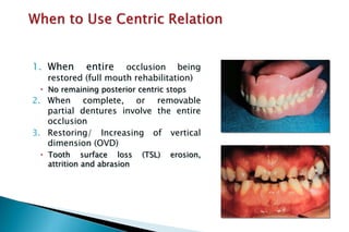 occlusion/jaw relation/ centric registeration 4th year tripoli | PPTX