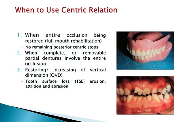 occlusion/jaw relation/ centric registeration 4th year tripoli | PPT