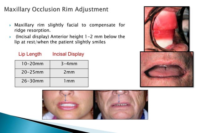occlusion/jaw relation/ centric registeration 4th year tripoli | PPTX ...