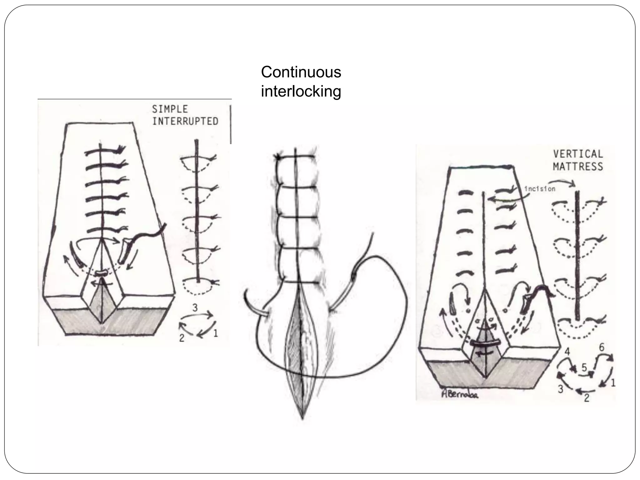 Bedside Procedure | PPTX