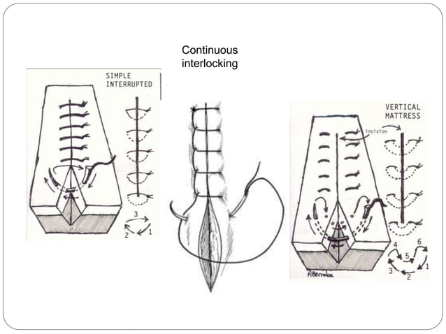 Bedside Procedure | PPTX