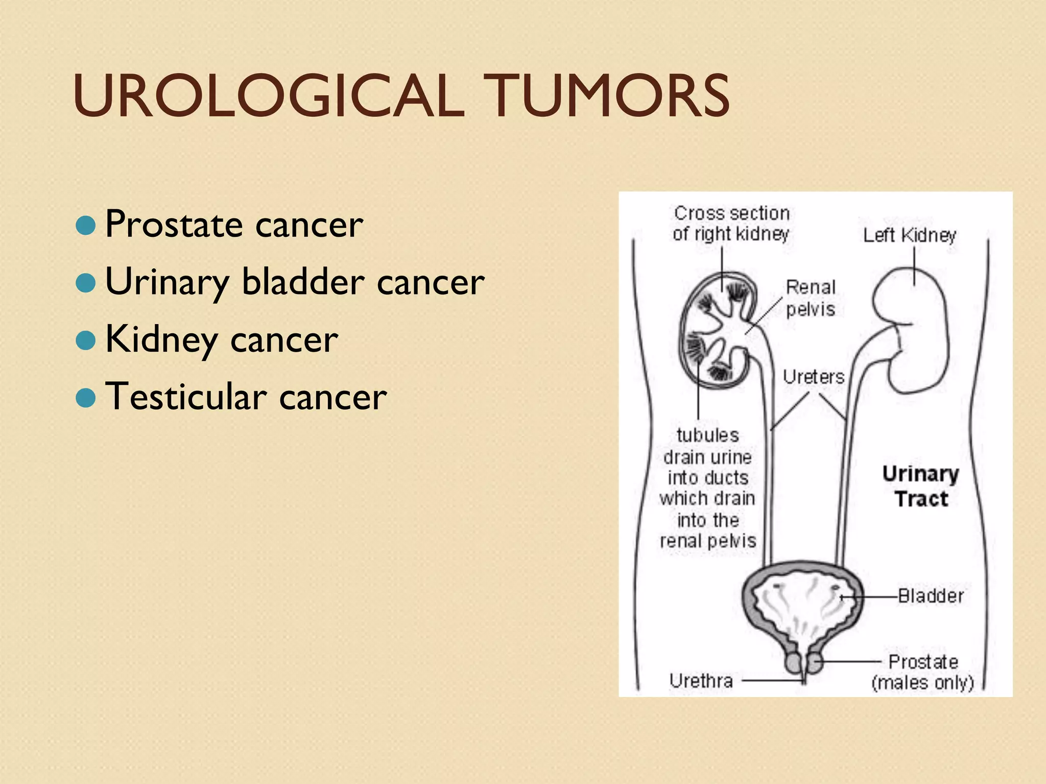 7 Oncourology.pptx