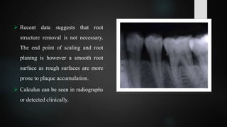 7periodontology lecture 4 | PPT