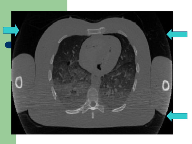 7 Physical principles of CT.pptasfbmhjugr | PPT