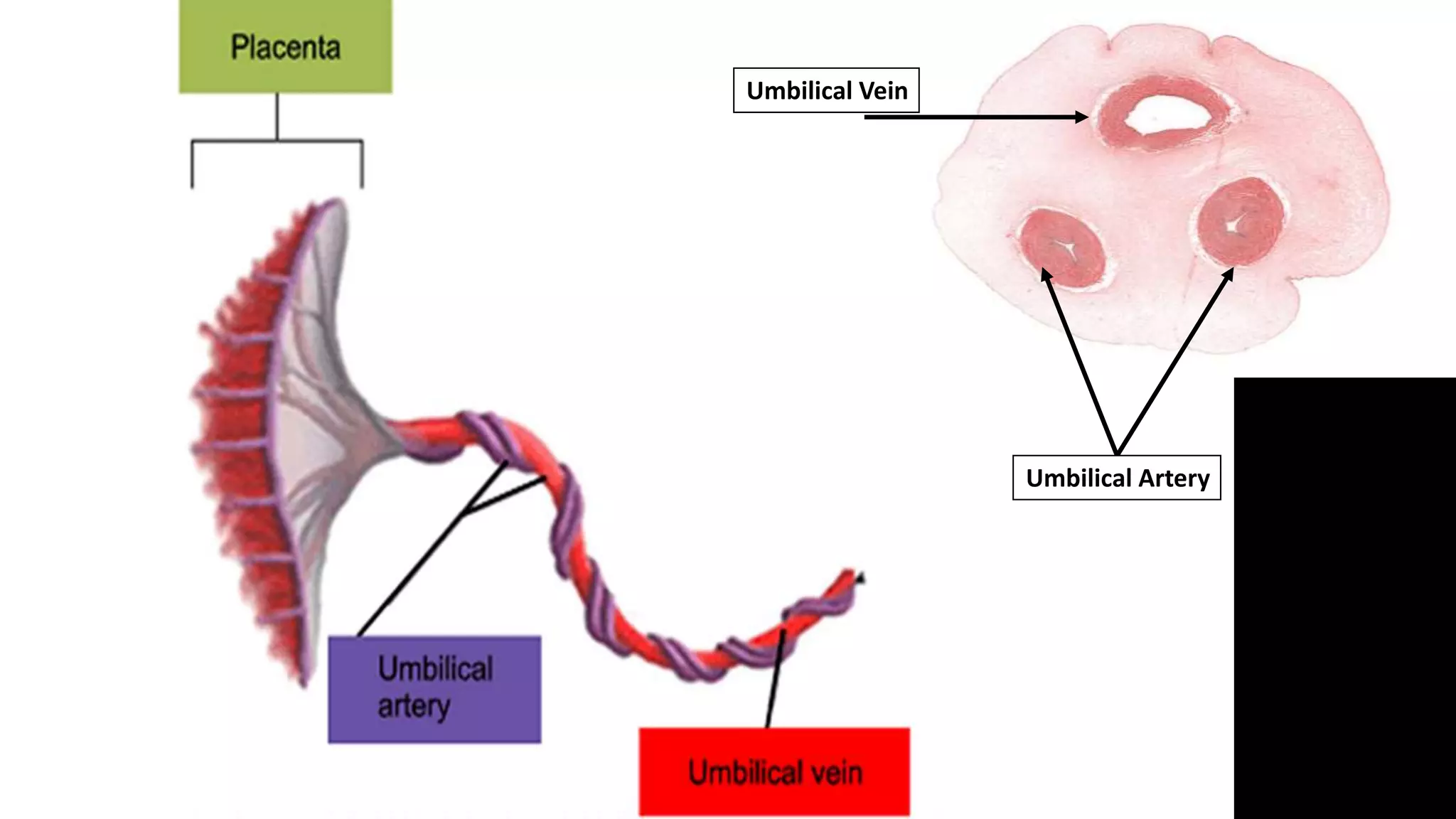 Antepartum Hemorrhage (APH) | PPTX