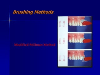 prevention of periodontal diseases | PPTX