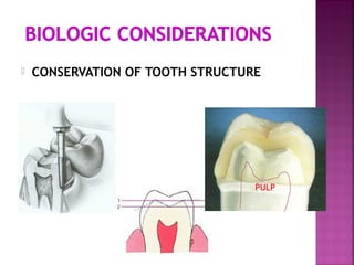 7 principles of tooth preparation rosenteal(dr_shimaghasemi@yahoo.com ...