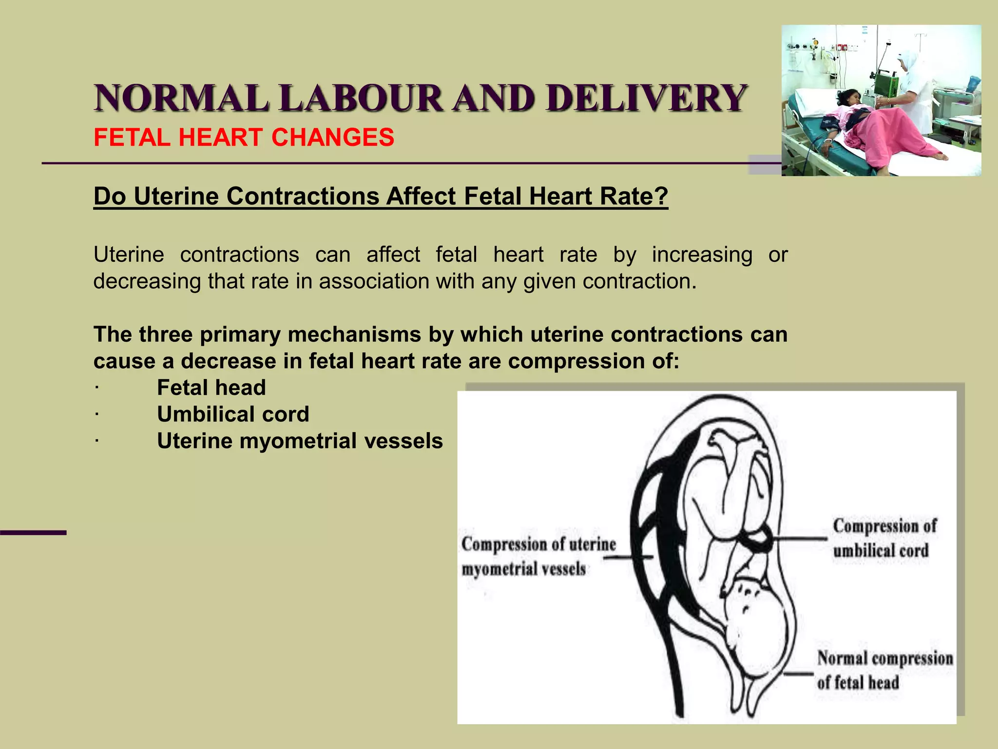 Normal labour and delivery | PPSX