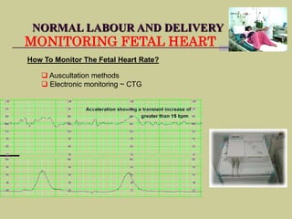 Normal labour and delivery | PPSX