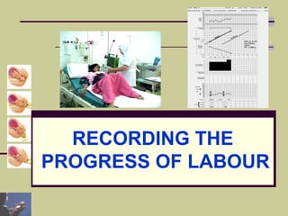 Normal labour and delivery | PPSX