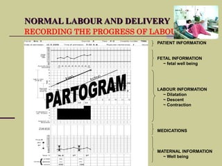 Normal labour and delivery | PPSX