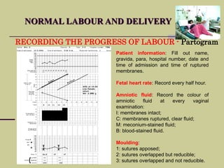 Normal labour and delivery | PPSX