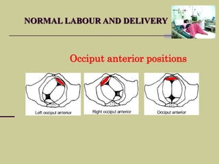 Normal labour and delivery | PPSX