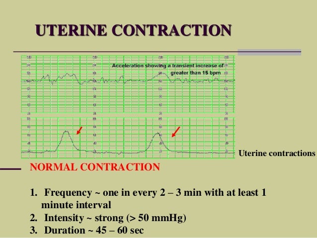Normal labour and delivery