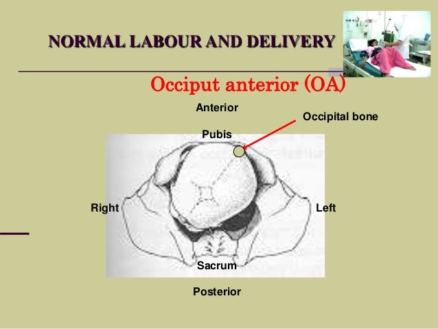Normal labour and delivery