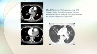 CTEPH Diagnosis and Medical Treatment Update | PPTX
