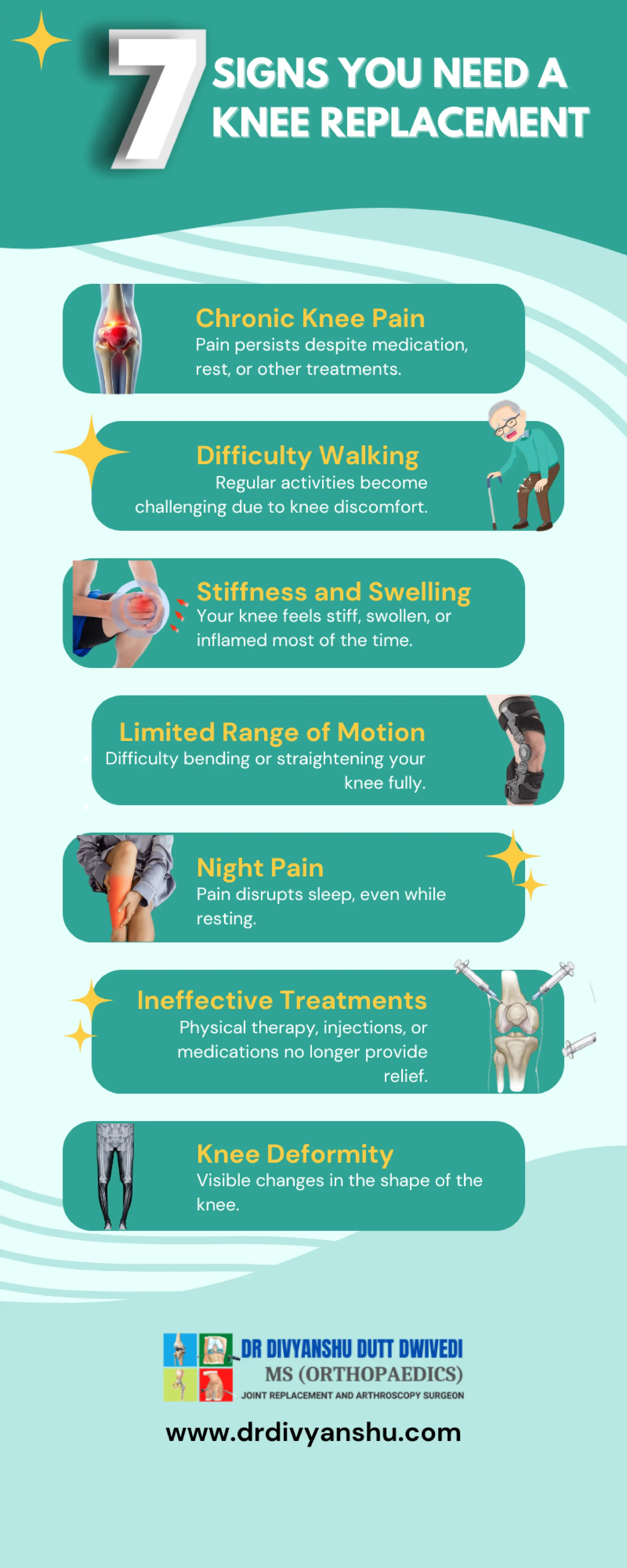 7 Signs You May Need a Knee Replacement. | PDF