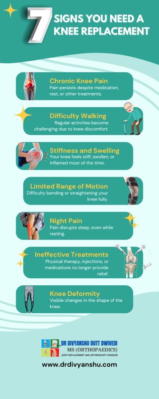 7 Signs You May Need a Knee Replacement. | PDF | Bone and Joint ...