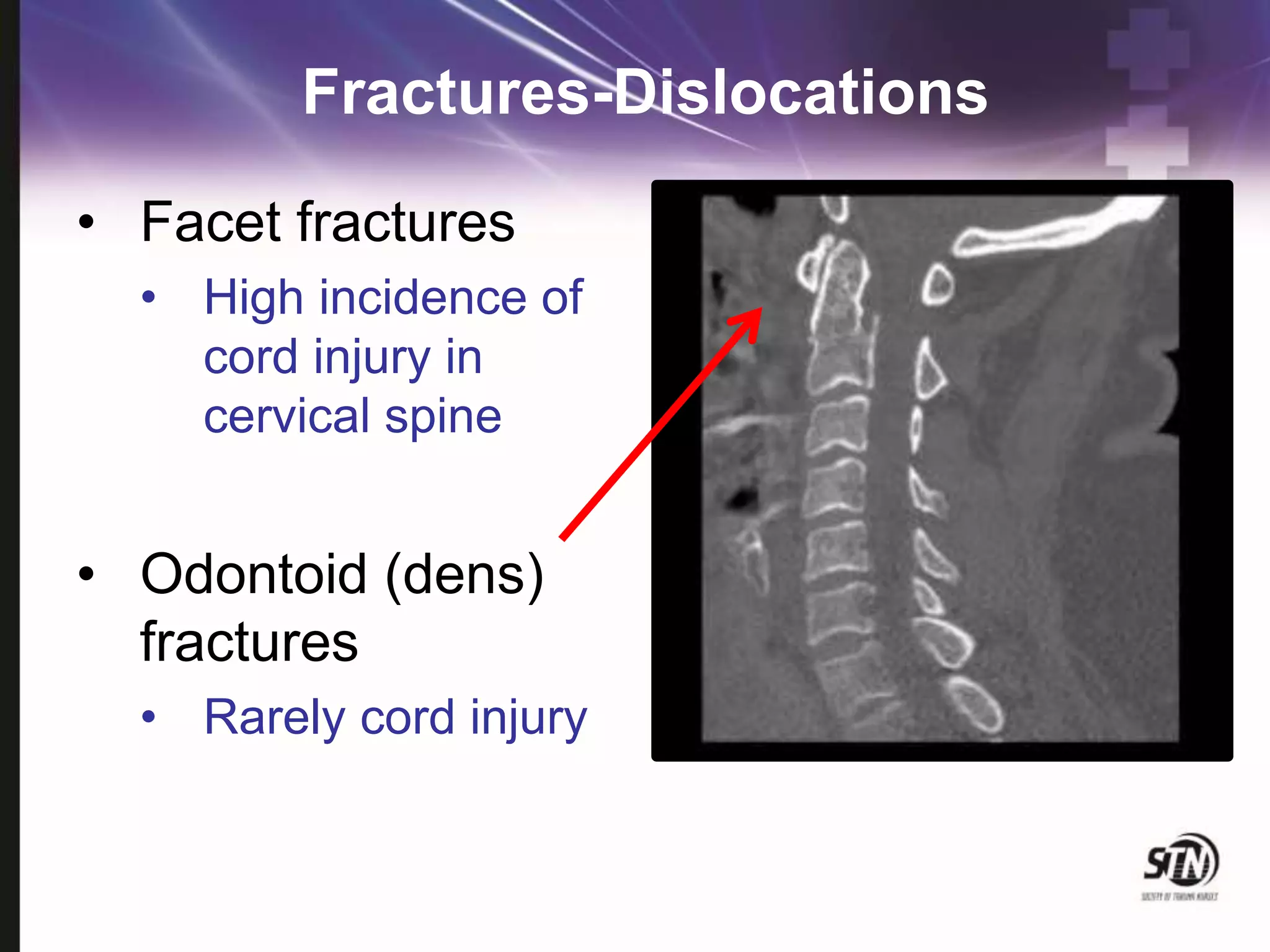 Spinal Column and Spinal Cord Injuries.pptx