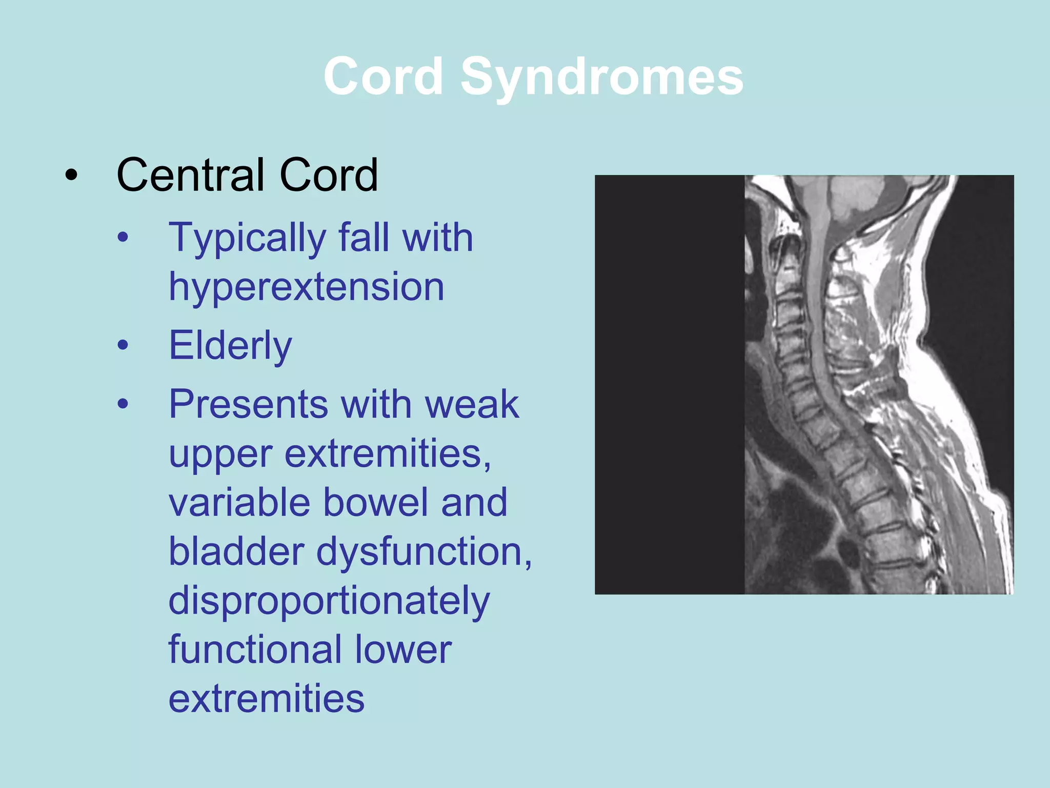 7_Spinal Column and Spinal Cord Injuries (1).pptx