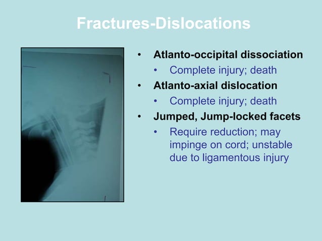 7_Spinal Column and Spinal Cord Injuries (1).pptx