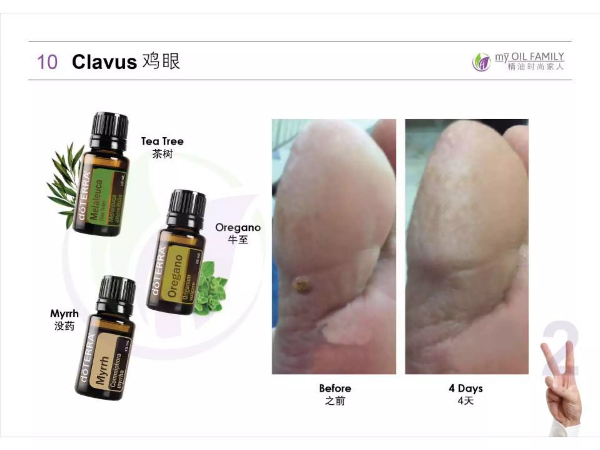 Doterra Essential Oil Testimonial | PPT