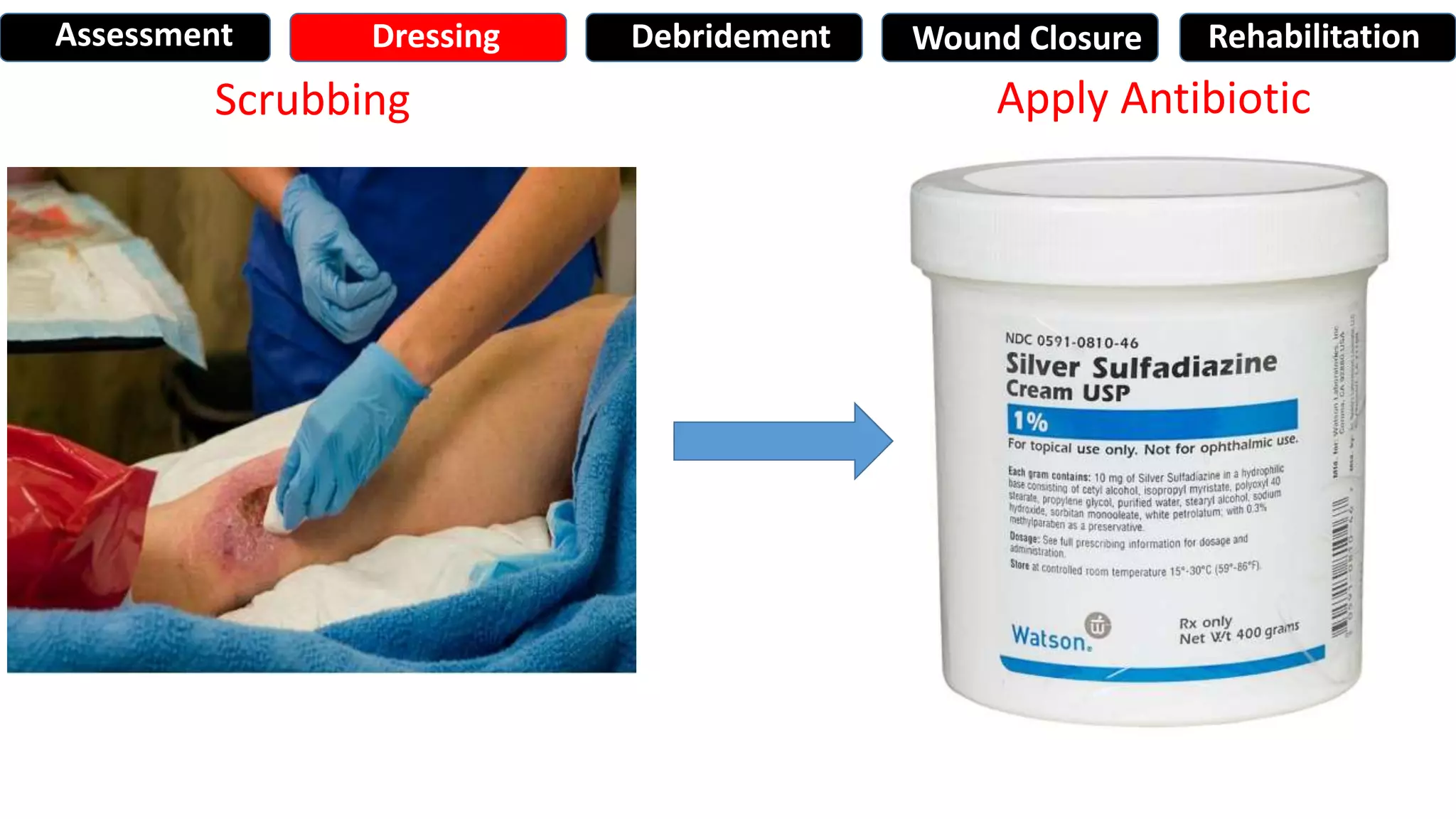 BURNS: Surgical Management | PPTX