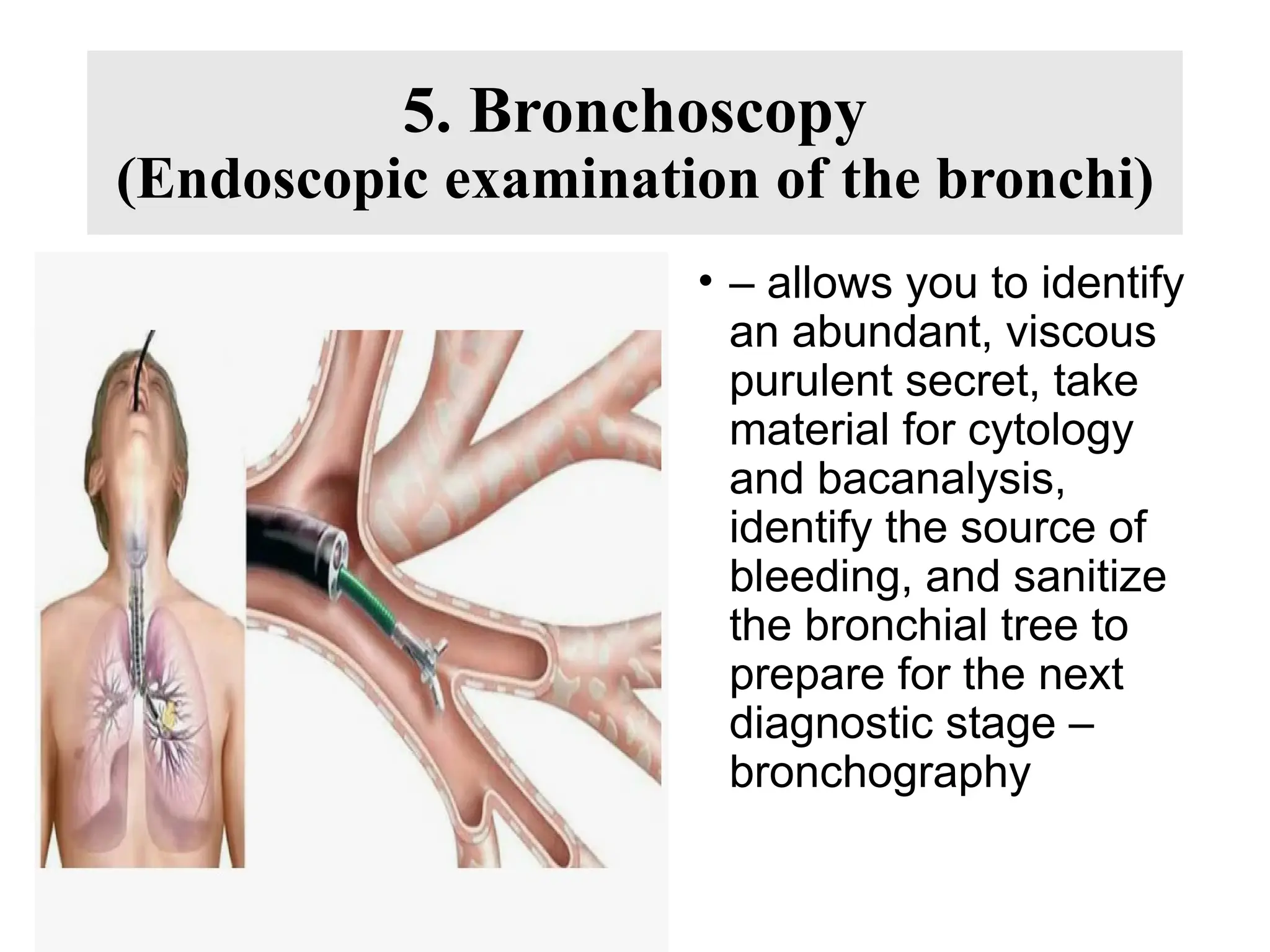Syndrome of pathological bronchial dilation.pptx