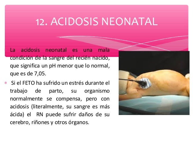 7° Terminologia de monitoreo fetal