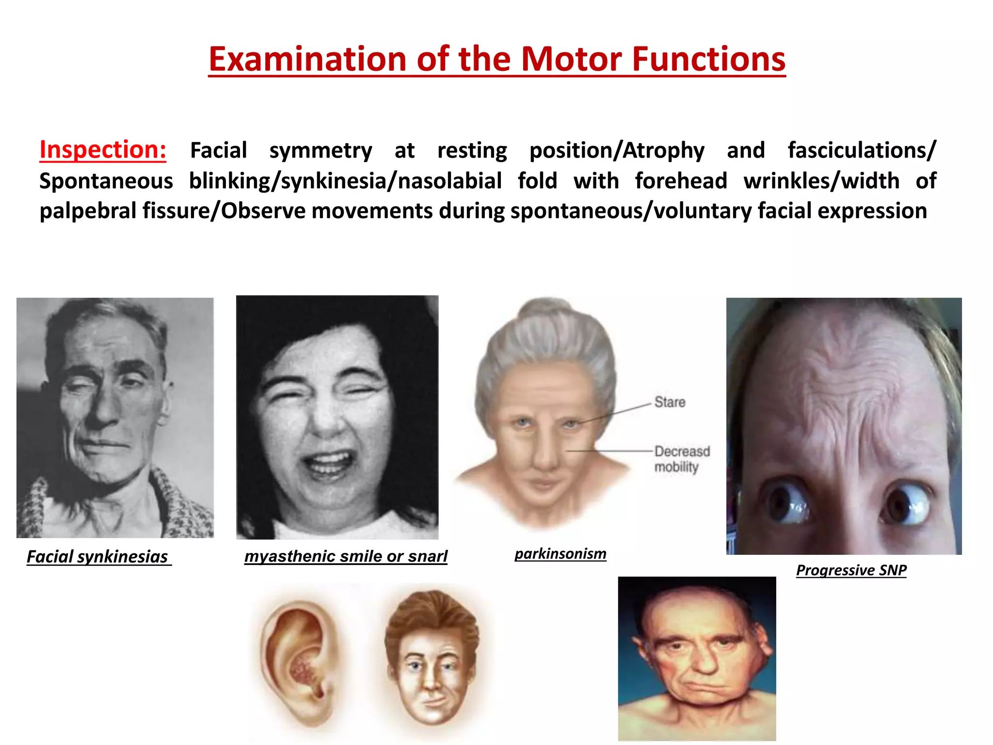 facial nerve examination | PPTX