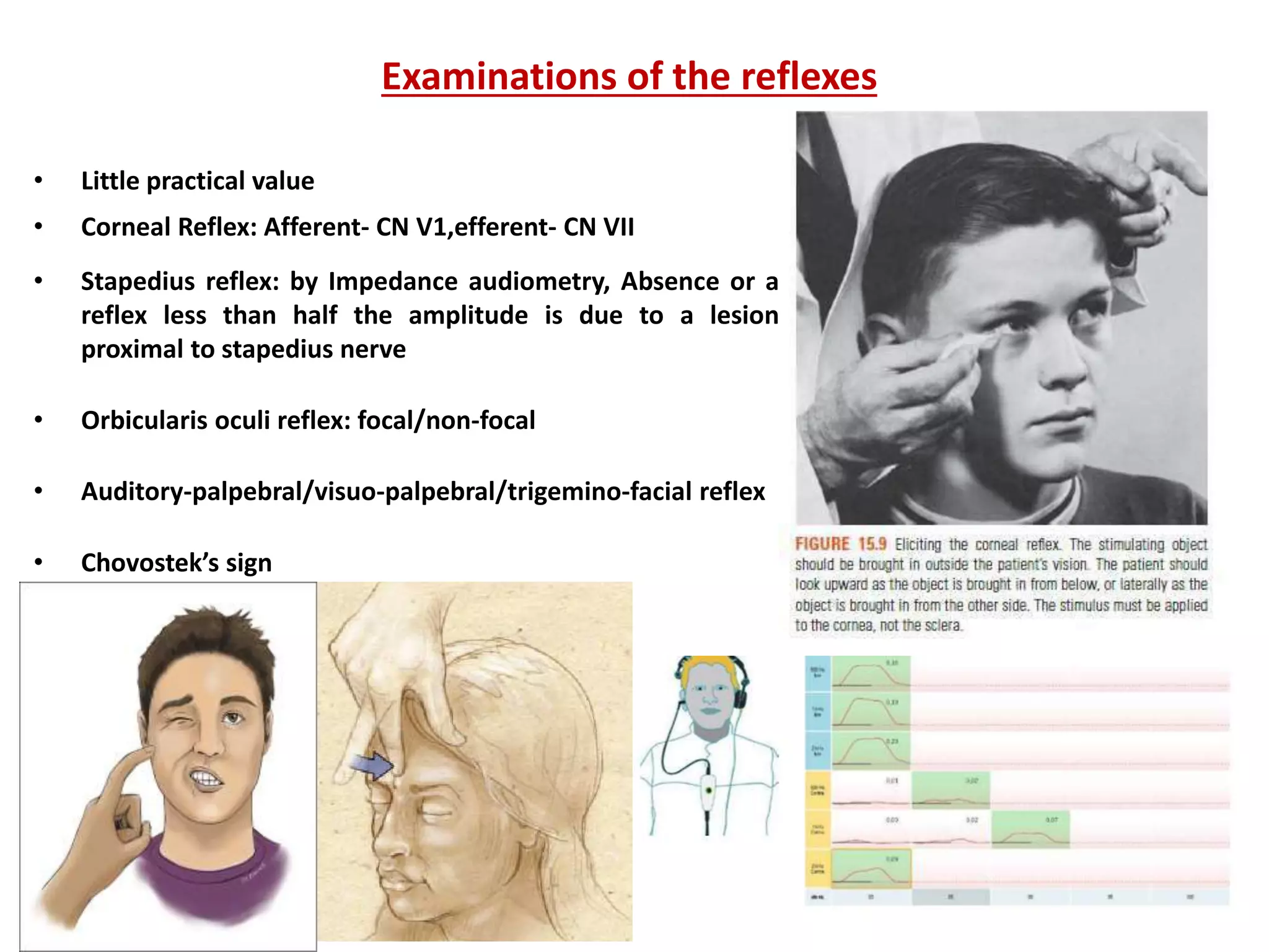 facial nerve examination | PPTX