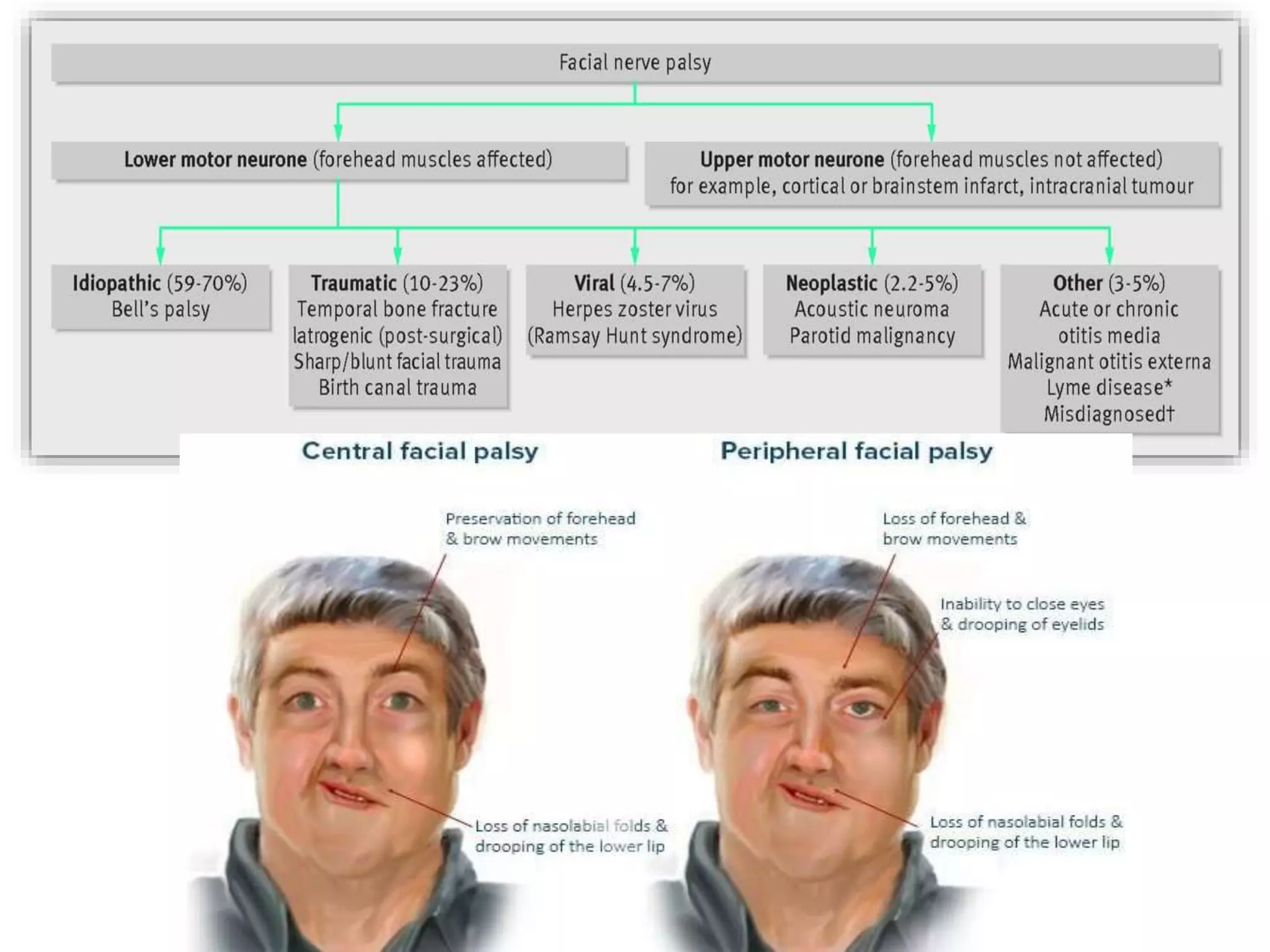 facial nerve examination | PPTX