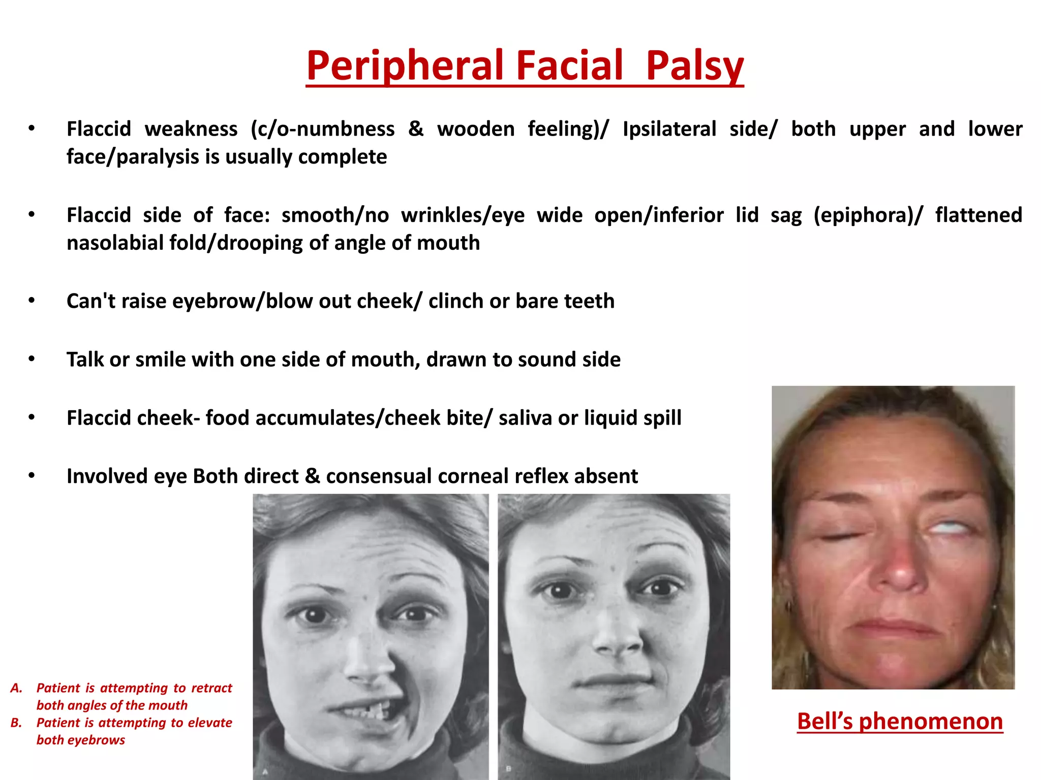 facial nerve examination | PPTX