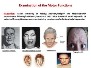 facial nerve examination | PPTX